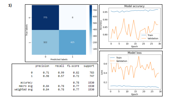 GitHub - Sadeepi/Pulmonary_Tuberculosis-_desease-detection