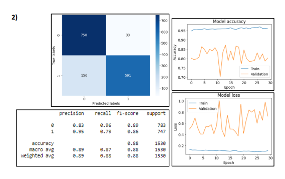 GitHub - Sadeepi/Pulmonary_Tuberculosis-_desease-detection