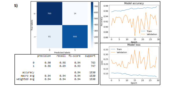 GitHub - Sadeepi/Pulmonary_Tuberculosis-_desease-detection