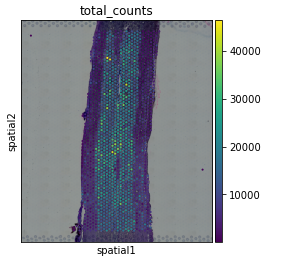 qTune error: subscript contains invalid names · Issue #40 · edward130603/BayesSpace · GitHub