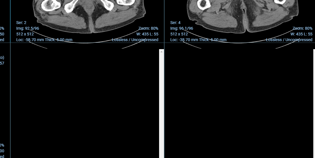 BUG/Error dcmjs On Empy Views · Issue #2771 · OHIF/Viewers · GitHub