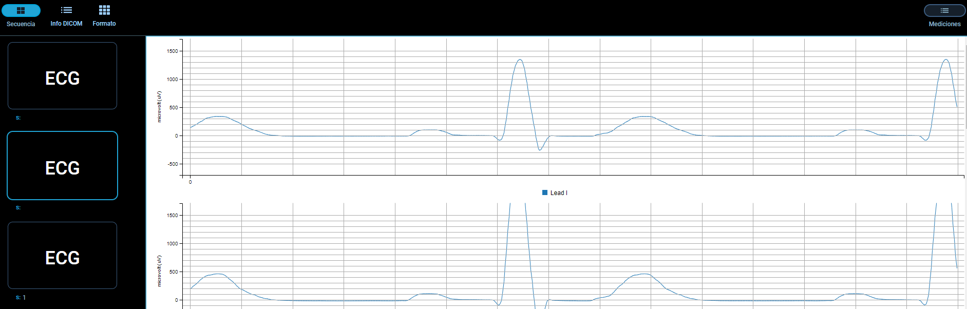 ECG (Electrocardiogram) Compatibility in Viewer (Extension) · Issue ...