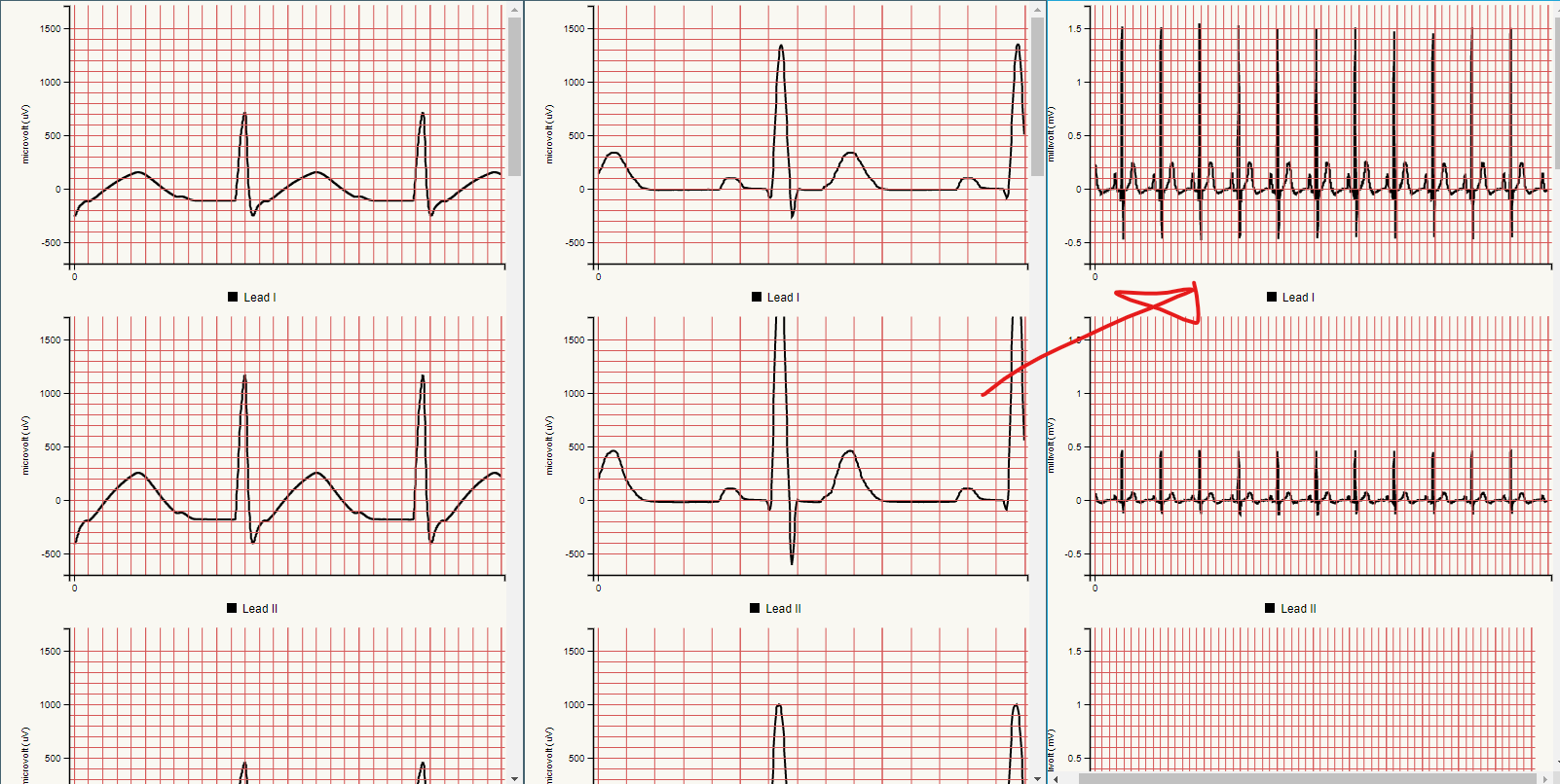 Improvements · Issue #4 · ArturRod/dicom-ecg · GitHub