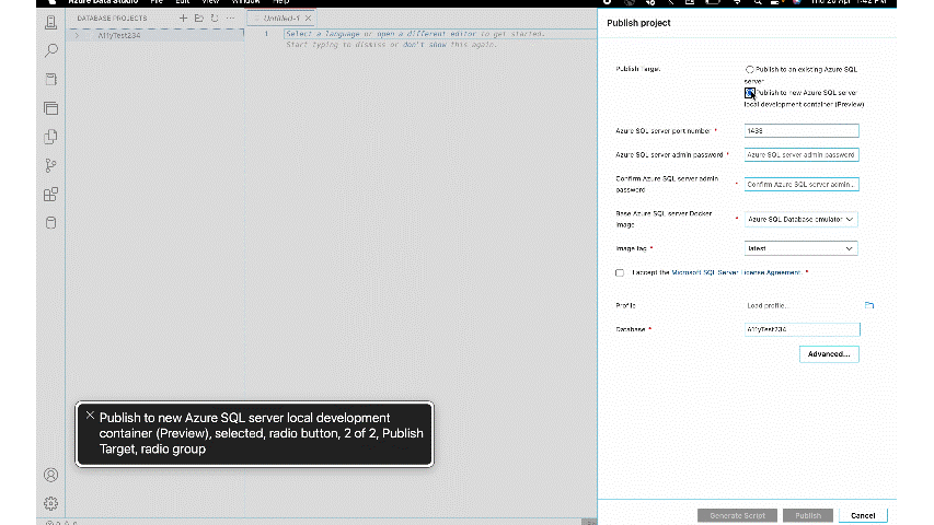 A11ysqldatabase Projects Extensioncreate New Database Projecttype Azure Sql Database 2912