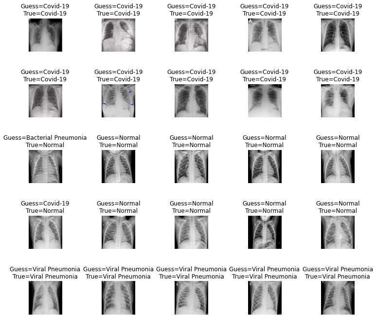 GitHub - pradeepsuyal/classifying_disease_with-chest_xray