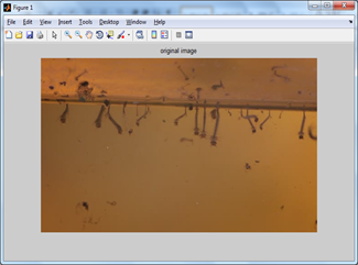 GitHub - SanjanaSanthosh/Image-Processing-Detects-Mosquito-Larvae: Using image processing ...