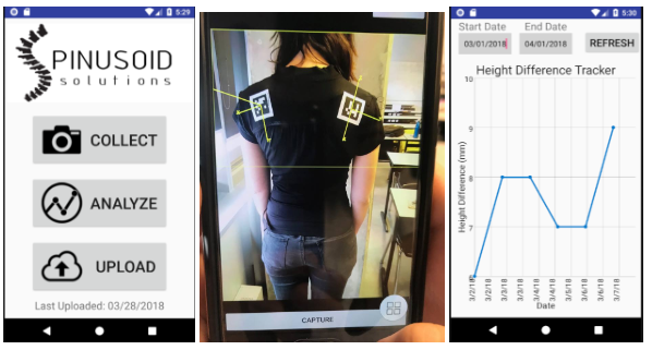 GitHub - francisrhee/SpinusoidSolutions: An Android app to track scoliosis.