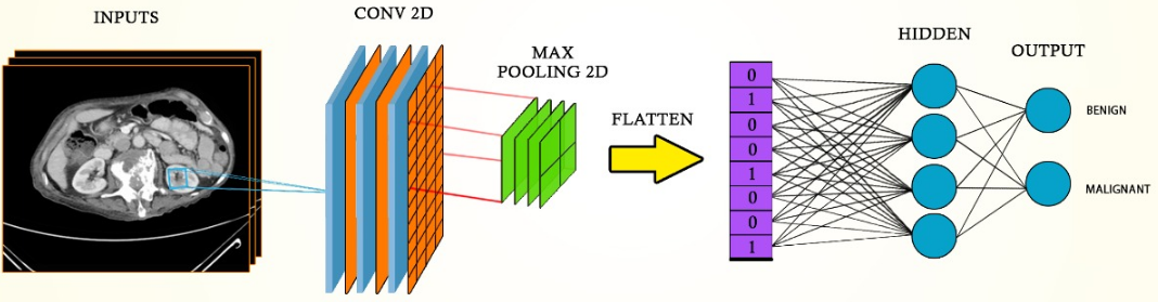 GitHub - DaliaAlzubi/Kidney_Tumor_Detection_And_Classification: Kidney Tumor Detection and ...