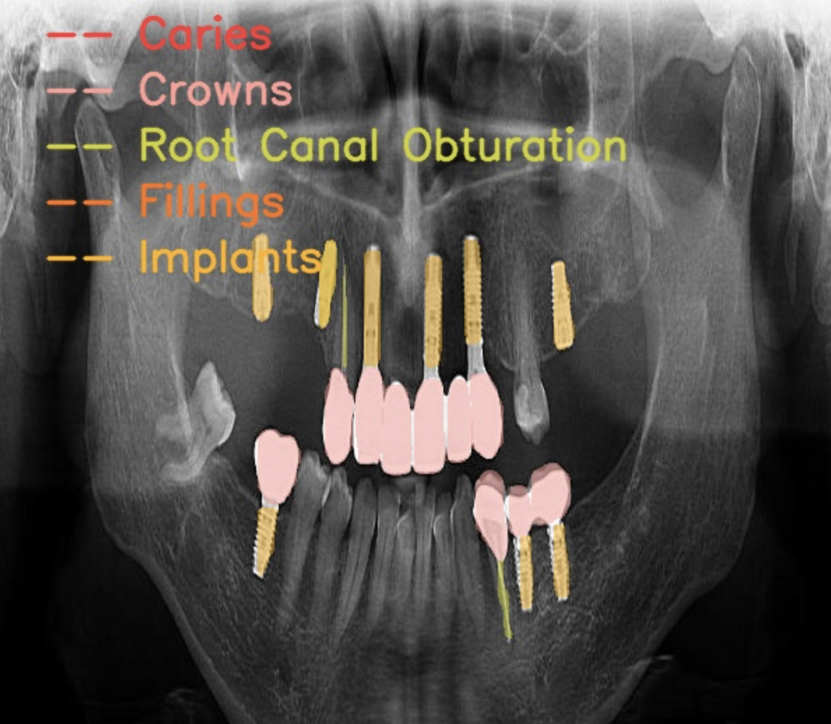 GitHub - DaliaAlzubi/yolo7-Panoramic_Segmentation