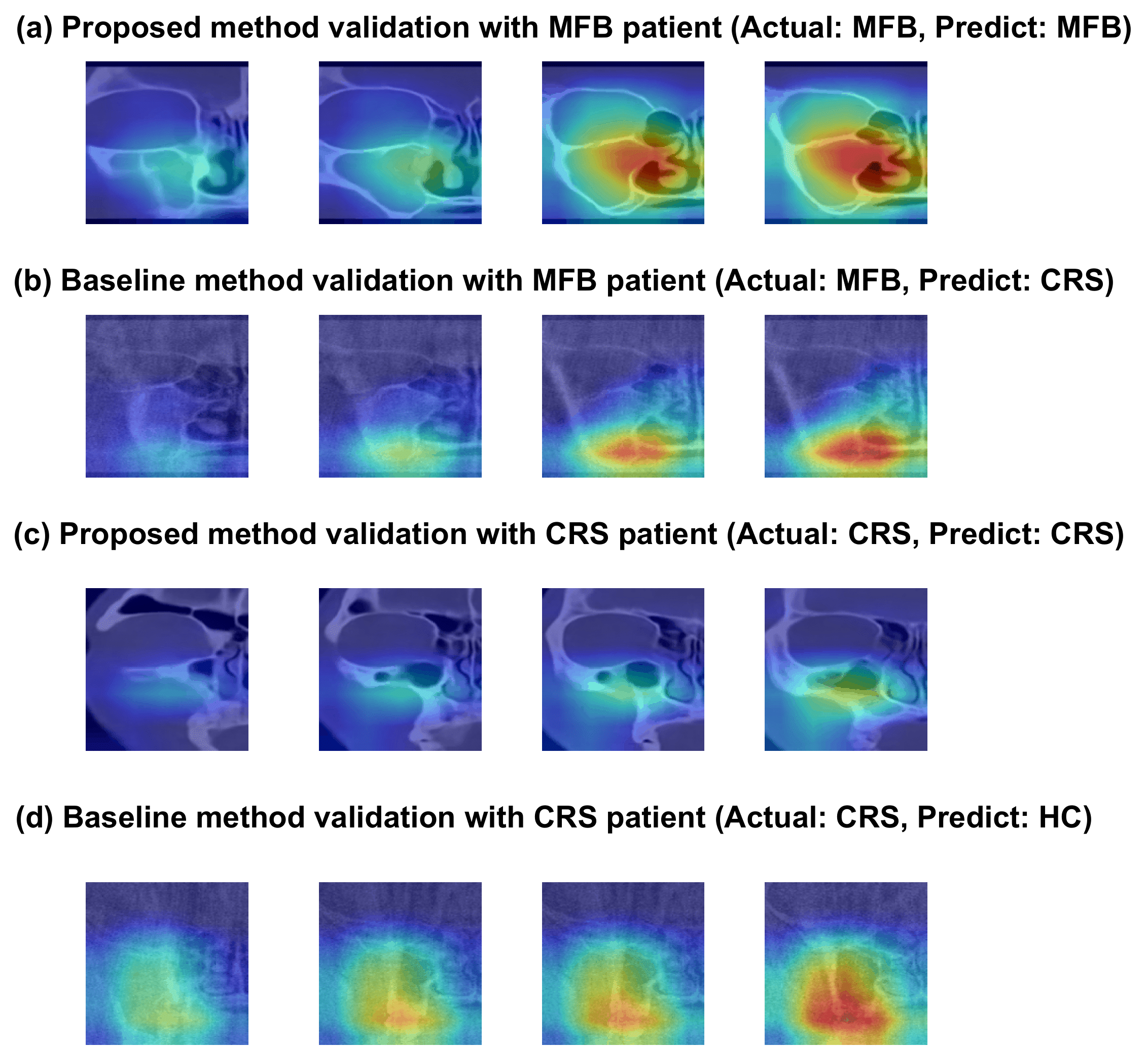 GitHub - LimChaeYeon1003/CBCT-OMU-CAD: CBCT_RECONSTRUCTION_CAD