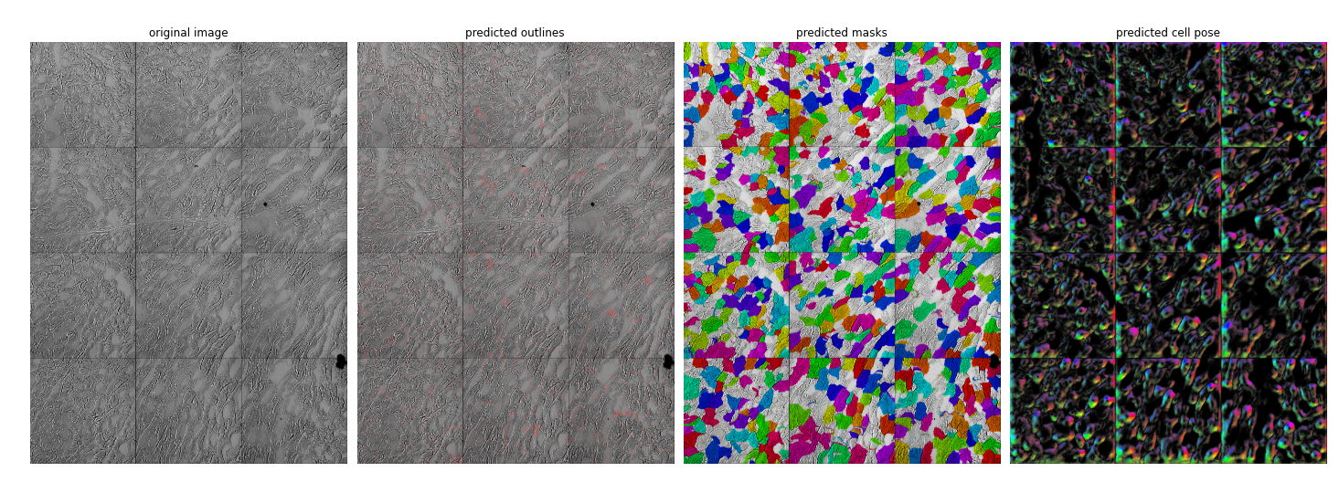 size problems with segmentation of very different and large cells · Issue #320 · MouseLand ...