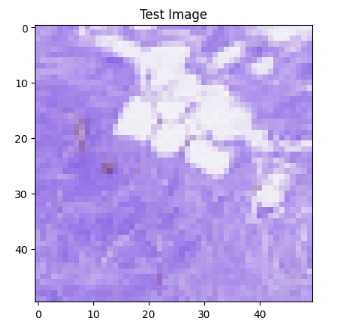 GitHub - narc-kany/Breast-Cancer-Detection-using-Breast-Histopathology ...