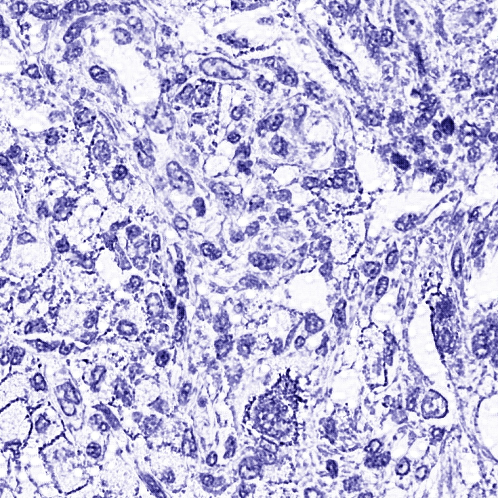 Decomposing Augmenting And Recombining Gives Purple Output · Issue 6648 · Scikit Imagescikit