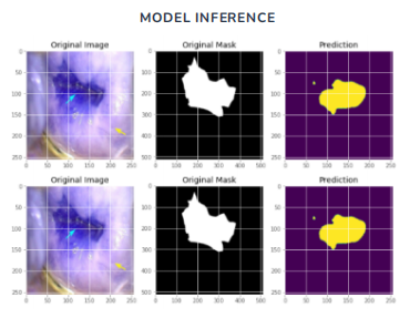 GitHub - Ares0098/Segmentation-of-the-Cervical-Columnar-using-the-Deep ...