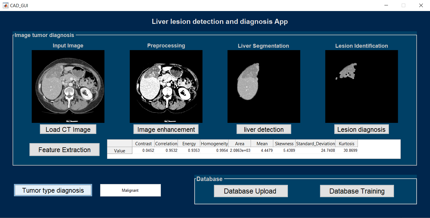 Automated-Liver-Tumor-Detection/README.md at main · di-ba/Automated ...