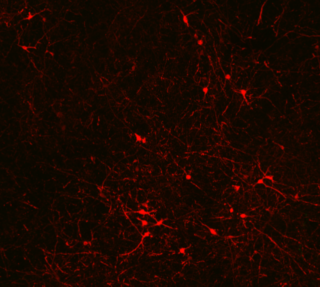 Segmentation of somas from oblongated cells · Issue #394 · MouseLand/cellpose · GitHub