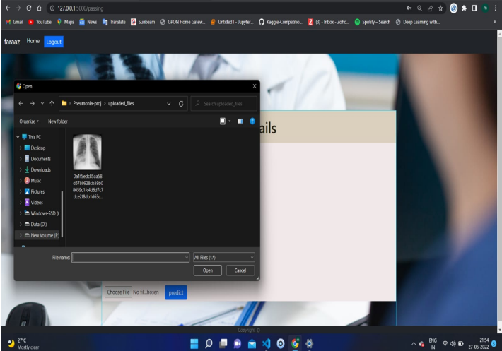 GitHub - AfraazKhan/Lung-X-Ray-Image-Enhancement-To-Identify-Pneumonia-With-CNN: We appraise the ...