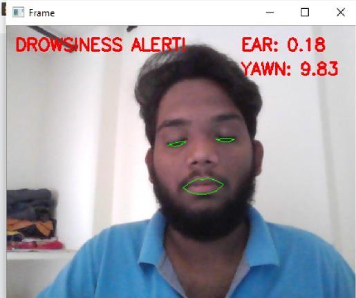 GitHub - munijayanth/Driver_Drowsiness_Detector: Drowsiness detector for Driver