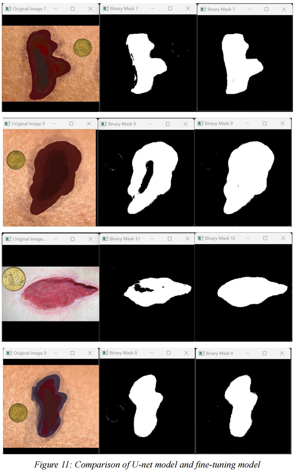GitHub - lucas-project/Woud_Detection_Machine_Learning: A medical ...