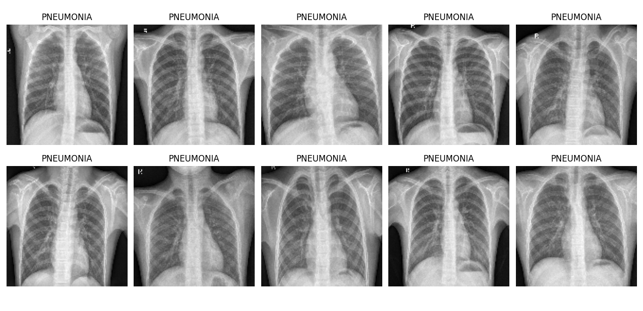 GitHub - herish23/Pneumonia-Detection-with-Convolutional-Neural ...