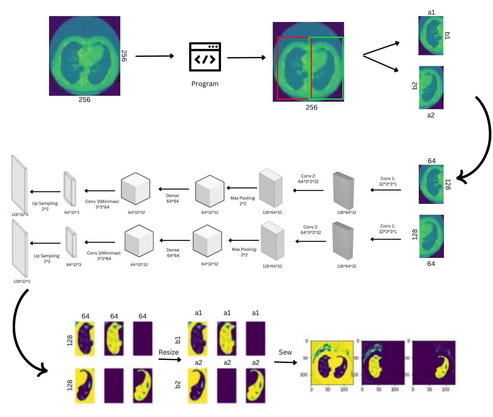 GitHub - Ironavenger475/Brain-Tumor-Segmentation-Using-Image-processing-