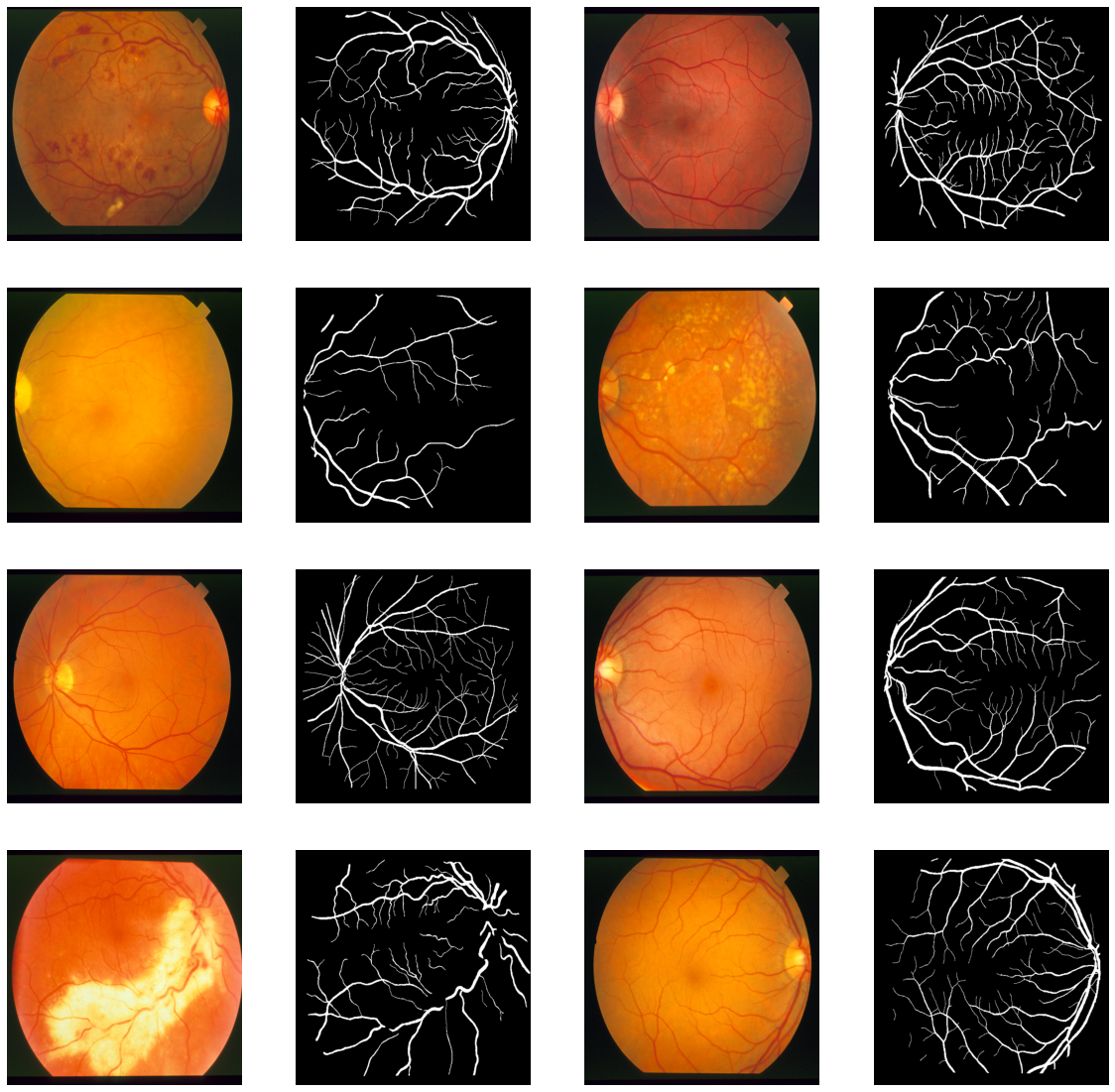 GitHub - shahzad3630/Vanilla-Unet