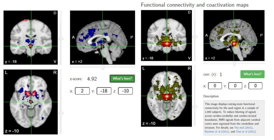 GitHub - petermartens98/NeuroSynth-Cognitive-fMRI-Analysis: In this ...