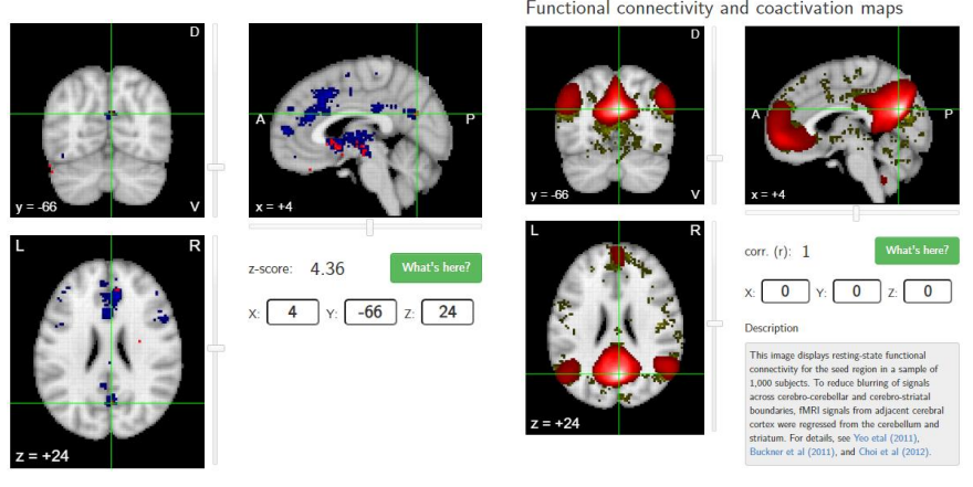 GitHub - petermartens98/NeuroSynth-Cognitive-fMRI-Analysis: In this Cognitive and Computational ...