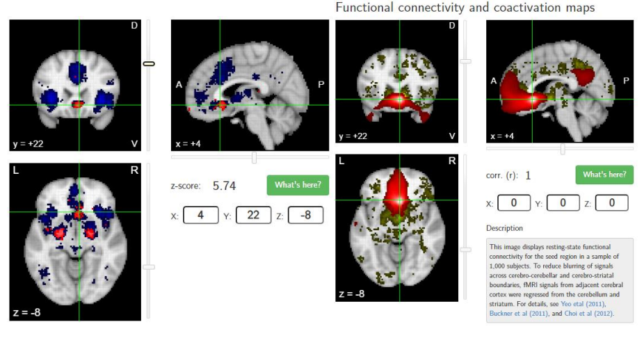 GitHub - petermartens98/NeuroSynth-Cognitive-fMRI-Analysis: In this Cognitive and Computational ...