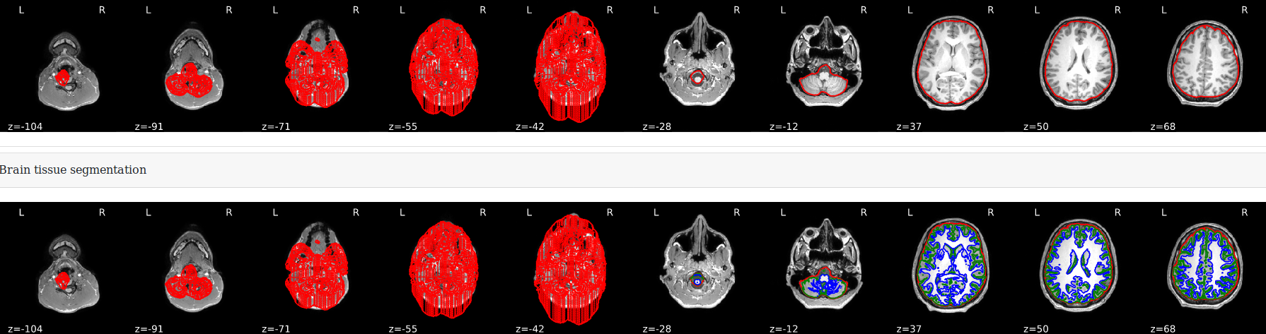 Weird brain masks · Issue #768 · nipreps/mriqc · GitHub