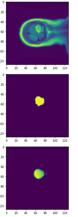 GitHub - Harmandeep-Kaur123/Brain_tumor-segmentation: It is a medical image analysis task that ...