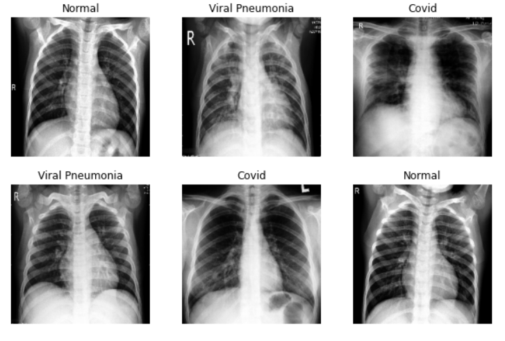GitHub - AlirezaKiaeipour/CovidDiagnosis-XRay