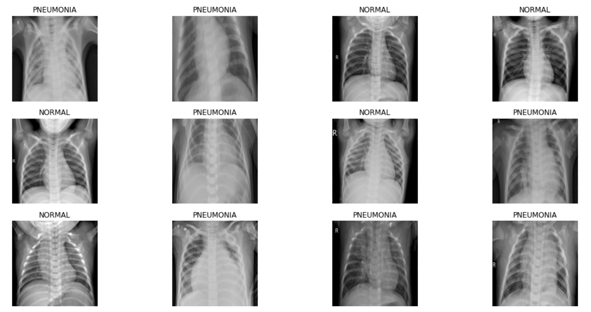 GitHub - AlirezaKiaeipour/XRay-TransferLearning