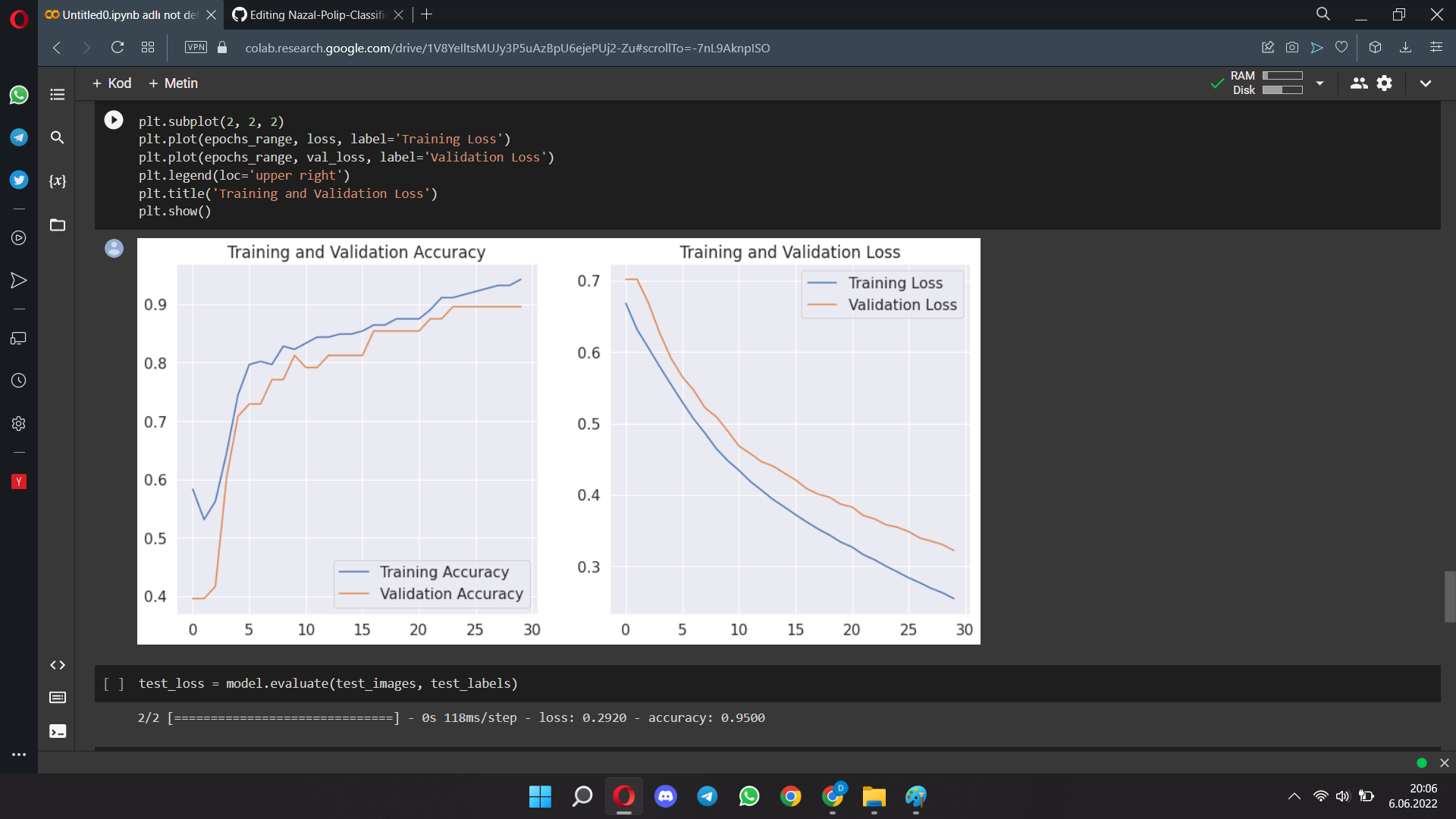 GitHub - uktuncer/Nazal-Polip-Classification