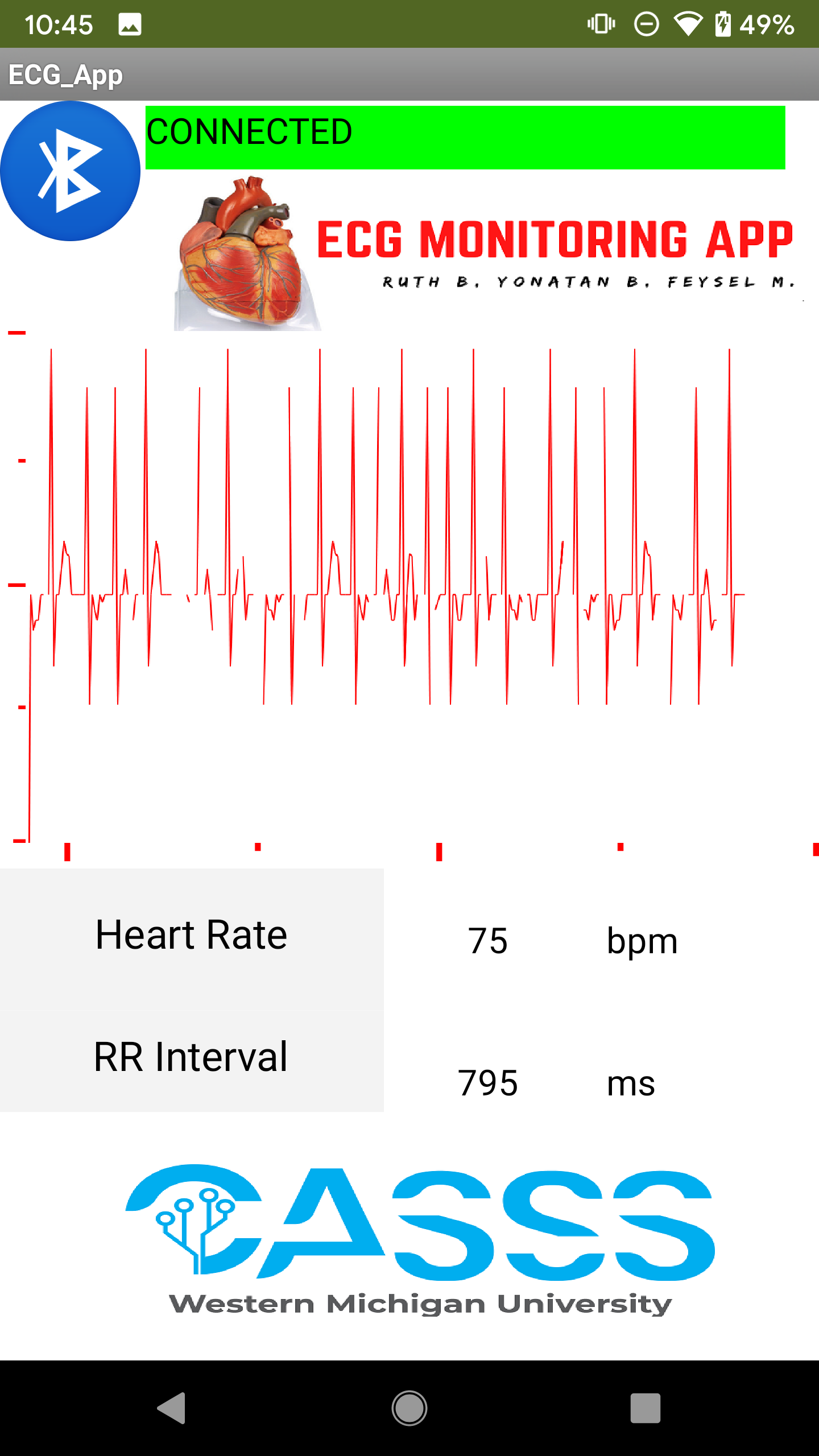 GitHub - yonbeyene/ECG-monitoring-device
