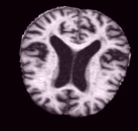 GitHub - shivram-dube/Simple-Data-fuison-using-Discrete-wavelet-transform: To develop a simple ...