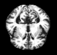 GitHub - shivram-dube/Simple-Data-fuison-using-Discrete-wavelet-transform: To develop a simple ...