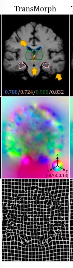 How To Visualise The Flow Field · Issue 56 · Junyuchen245 Transmorph