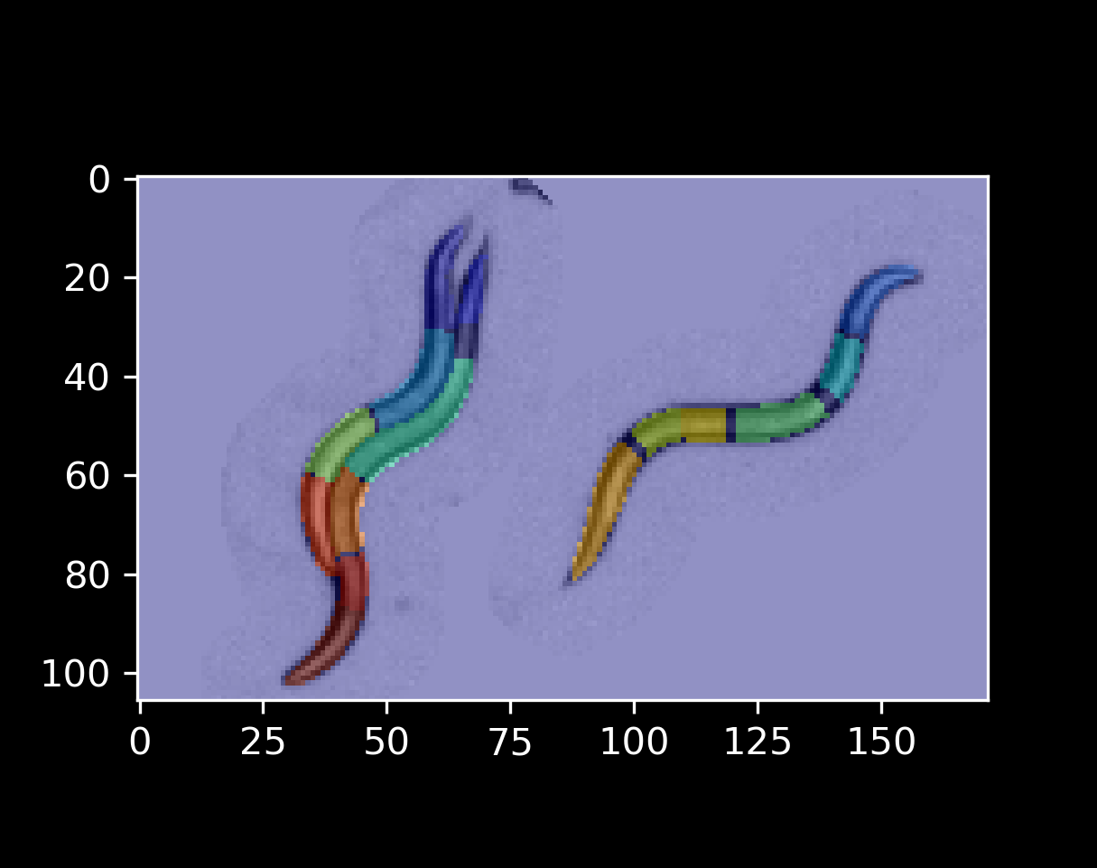 Over-segmentation · Issue #5 · kevinjohncutler/omnipose · GitHub
