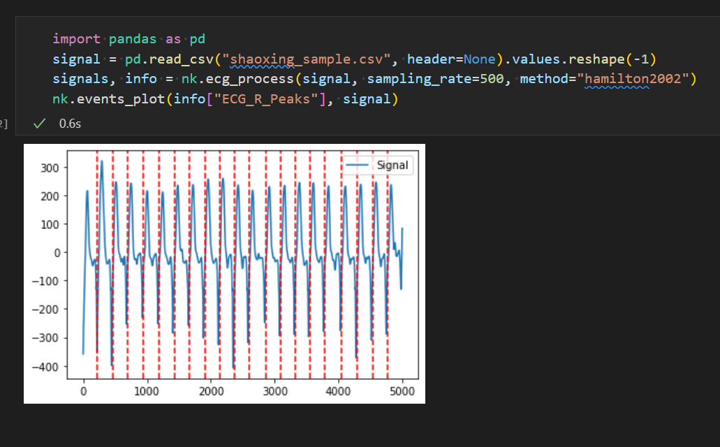 RR peaks extraction on Shaoxing ECG dataset leads to an error · Issue #773 · neuropsychology ...