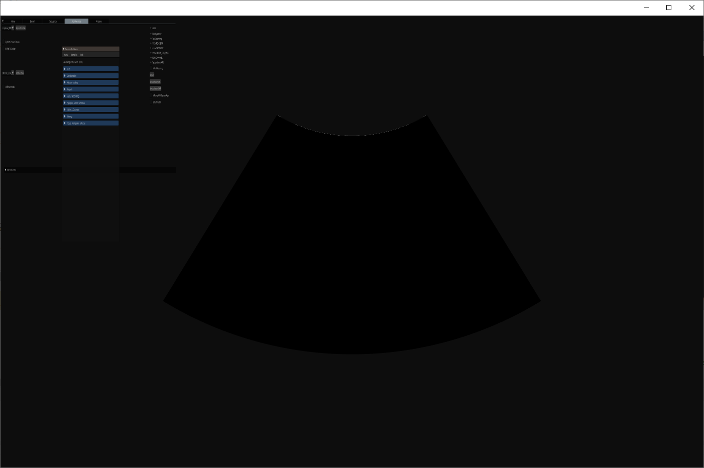 ImGui sizing issue with Vulkan · Issue #4886 · ocornut/imgui · GitHub