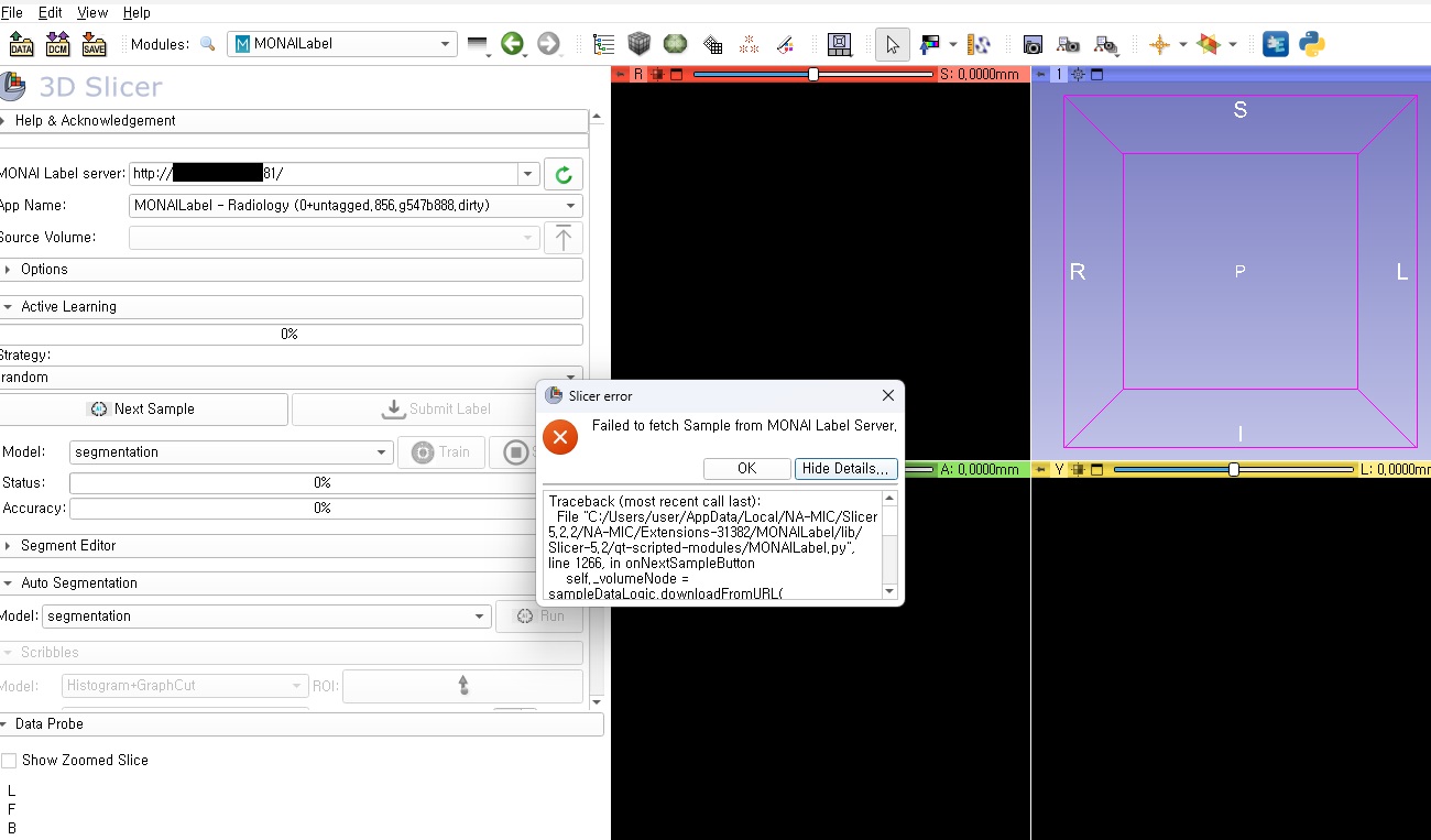 Error Downloading Ct Image With Monailabel In 3d Slicer · Issue 1391 · Project Monai Monailabel