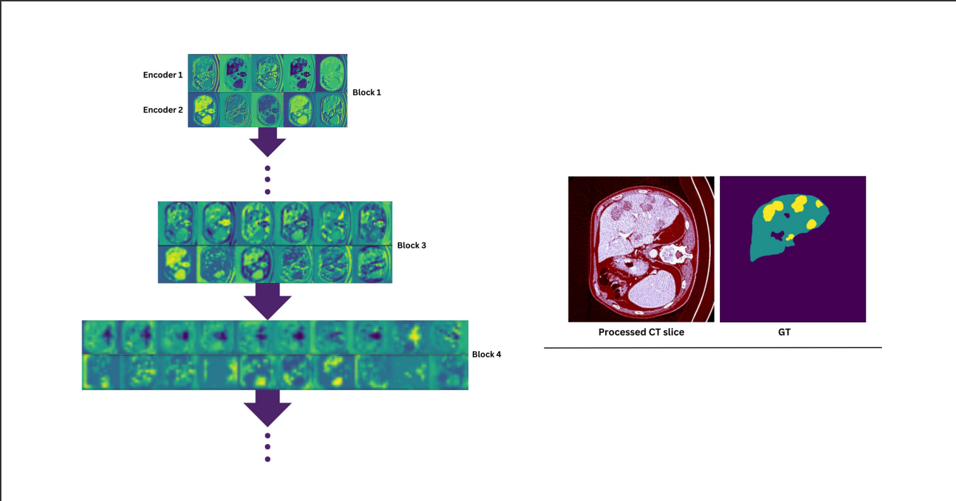 GitHub - Sourjya261/Livertumor_segmentation_W_Net