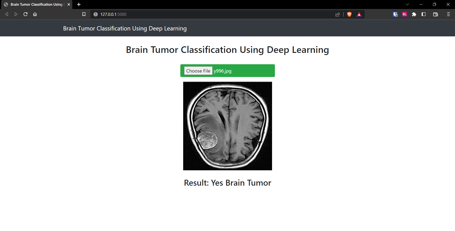 GitHub - ShamanChandini/Brain-Tumor-Detection-using-Convolutional ...