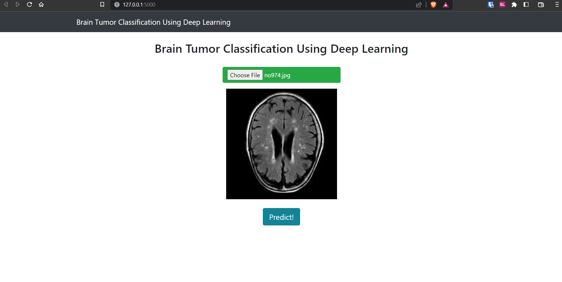 GitHub - ShamanChandini/Brain-Tumor-Detection-using-Convolutional ...