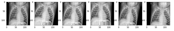 GitHub - katehee/pneumonia-detection-in-X-ray-images: CNN & transfer ...