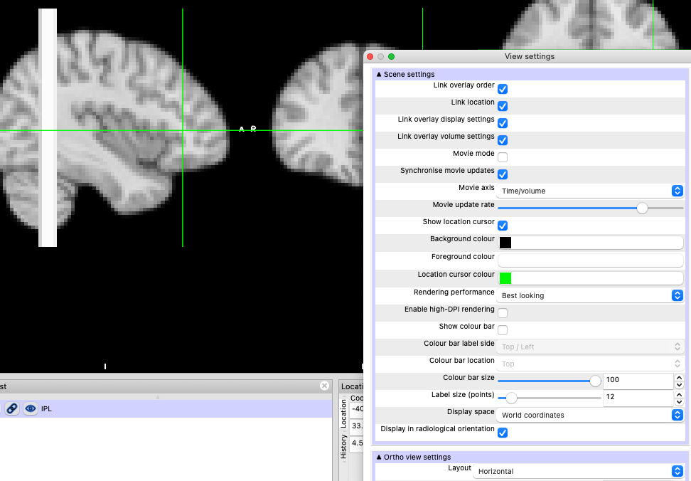 LPS orientation to RAS orientation on dcm2niix affine matrix · Issue ...