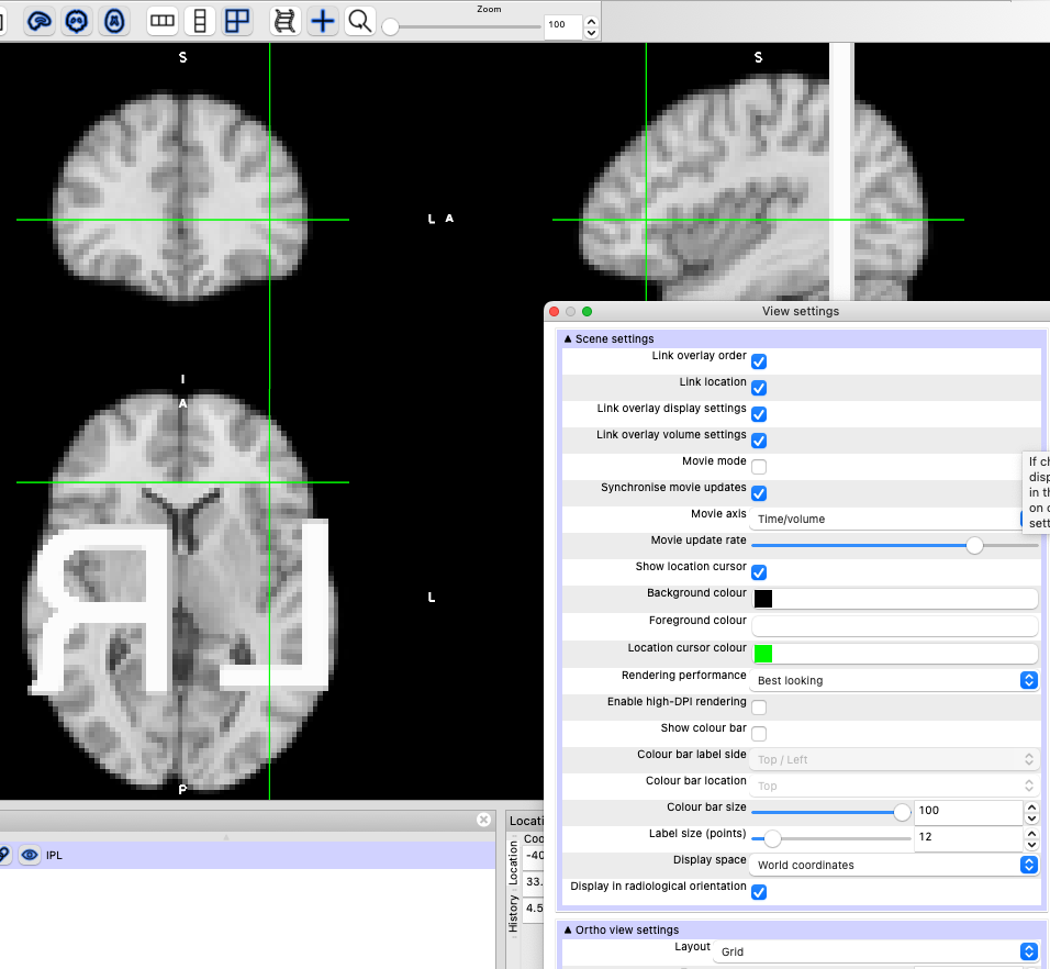 LPS orientation to RAS orientation on dcm2niix affine matrix · Issue ...