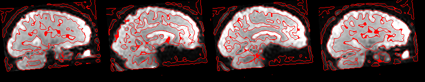 Load PNG as main image · Issue #144 · niivue/niivue · GitHub