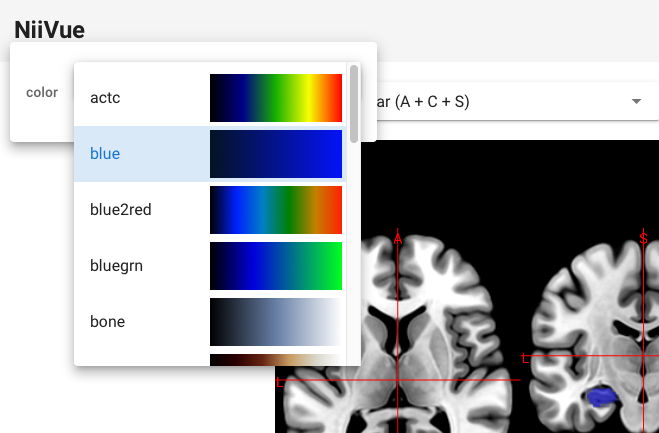 Other option to define color · Issue #151 · niivue/niivue · GitHub